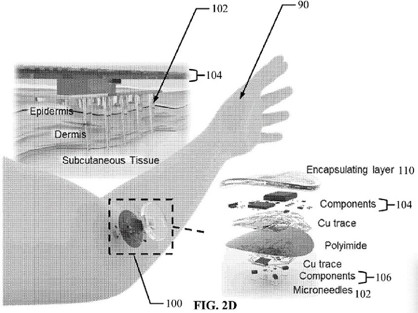 A Wearable For Deep Tissue Sensing Automated Drug Delivery Bioworld